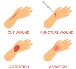 The Writer’s Guide to Cuts and Lacerations | Rebecca Shedd - Author