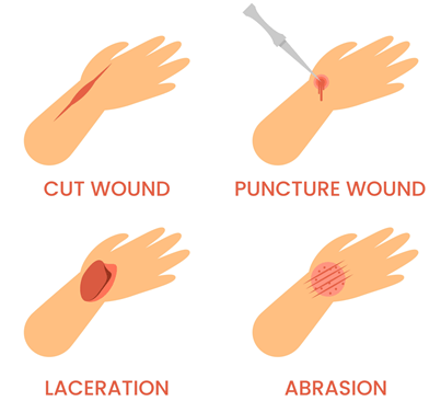 The Writer’s Guide to Cuts and Lacerations | Rebecca Shedd - Author