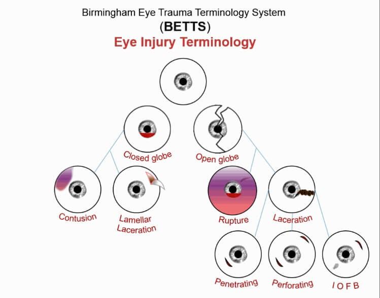The Writer’s Guide to Eye Injuries | Rebecca Shedd - Author